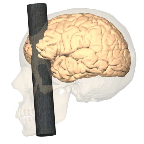 Ảnh hưởng từ ca bệnh của Phineas Gage lên tâm lý học (Phineas Gage’s ...