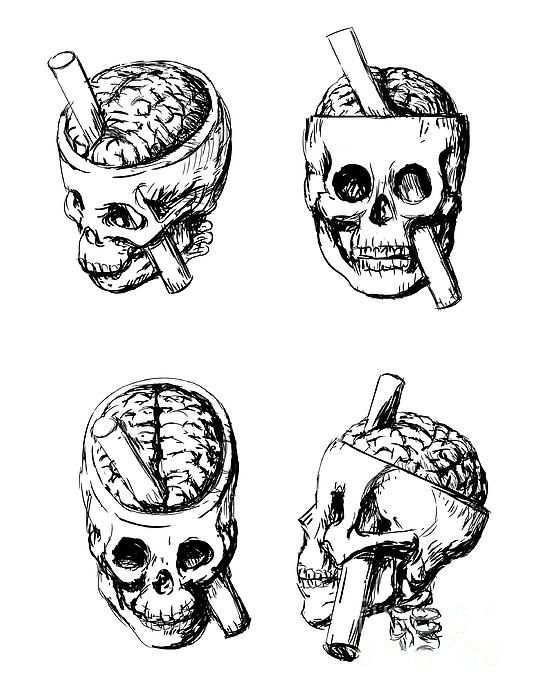 Ảnh hưởng từ ca bệnh của Phineas Gage lên tâm lý học (Phineas Gage’s ...